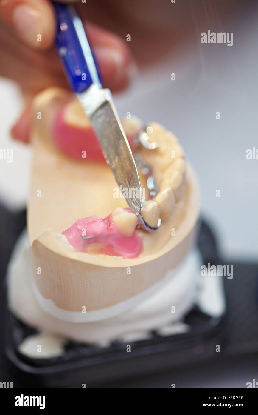 Work on dentures with modeling wax in a dental laboratory Stock Photo ...