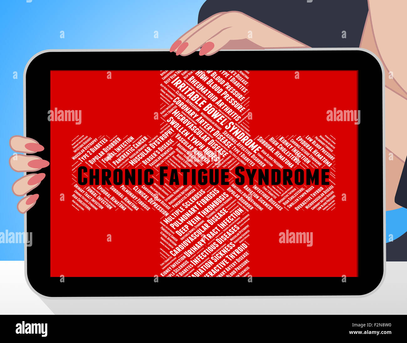 Chronic Fatigue Syndrome Showing Long Standing And Infection Stock ...