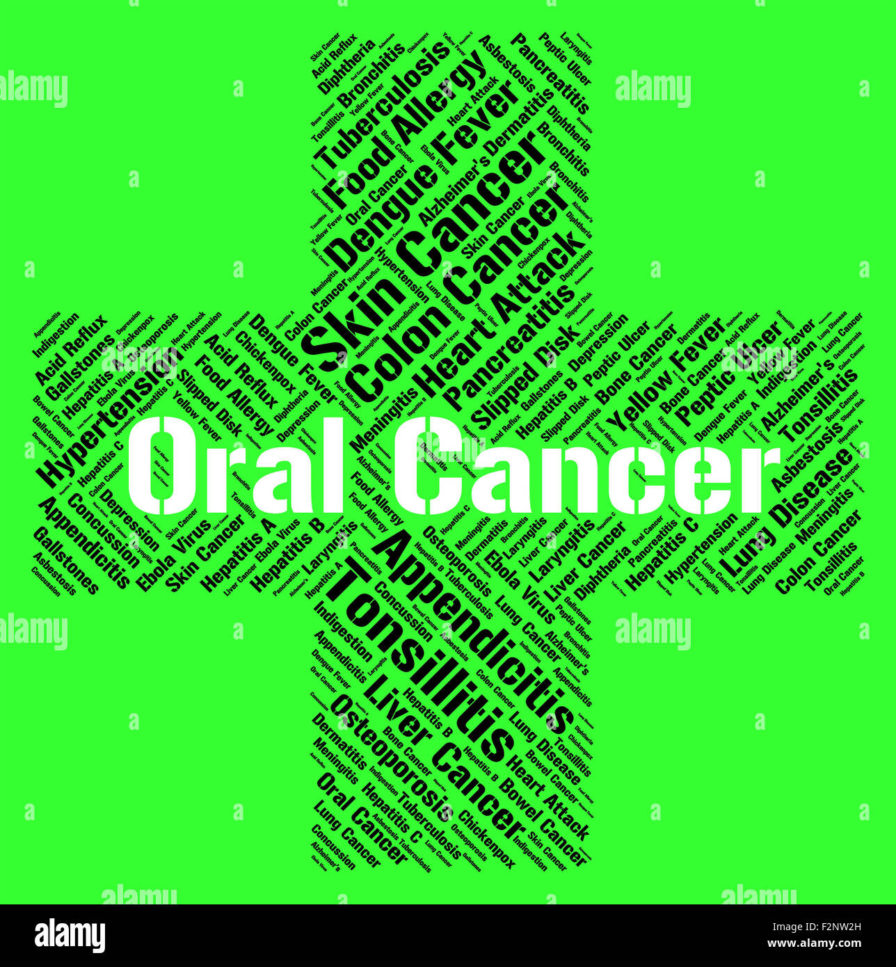 Oral Cancer Showing Cancerous Growth And Sickness Stock Photo - Alamy