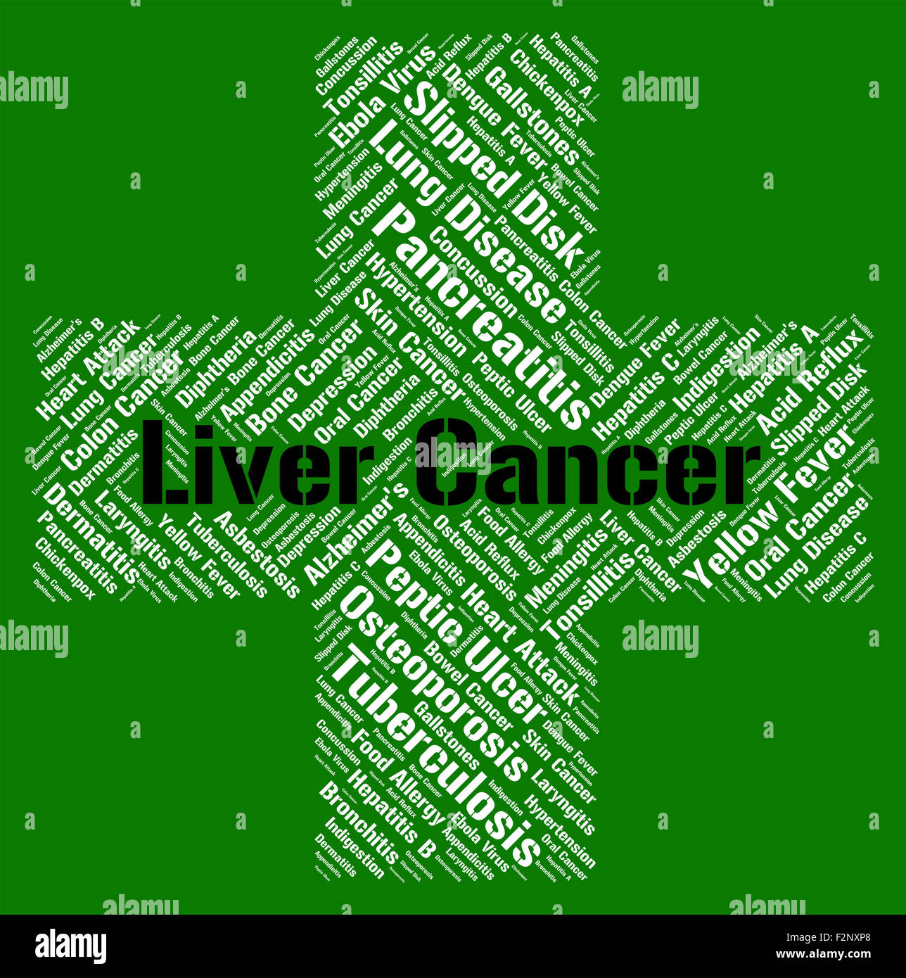 Liver cancer hi-res stock photography and images - Alamy