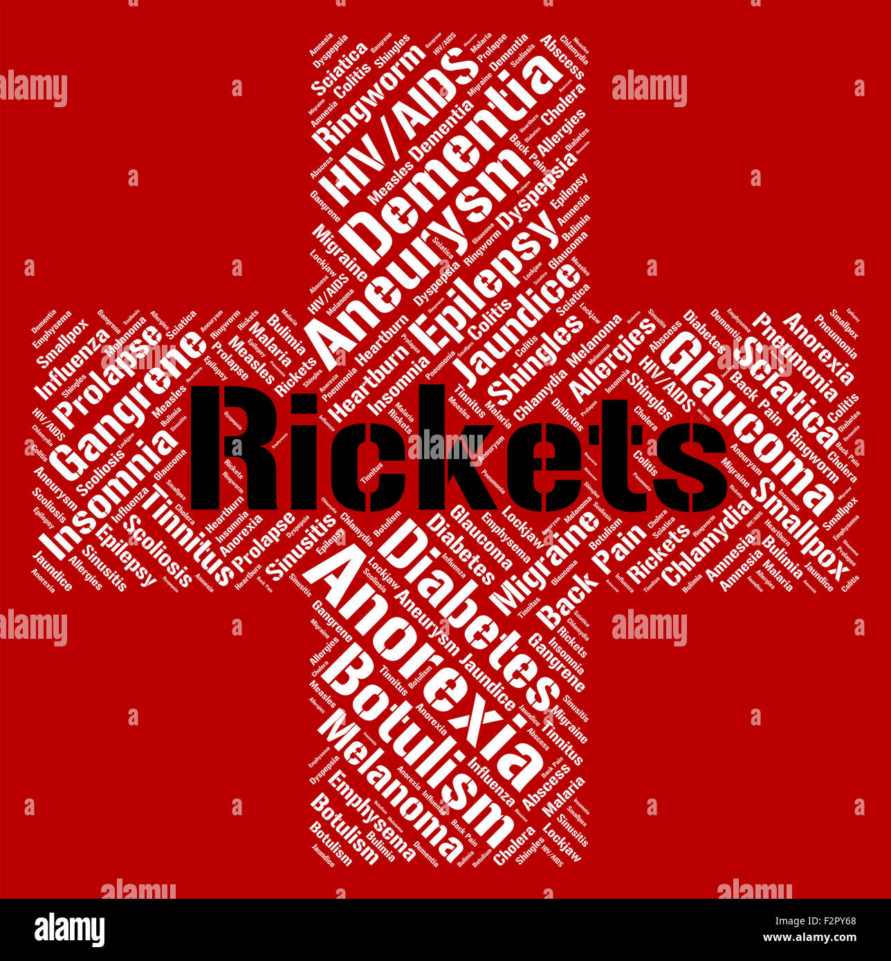 Rickets disease hi-res stock photography and images - Alamy