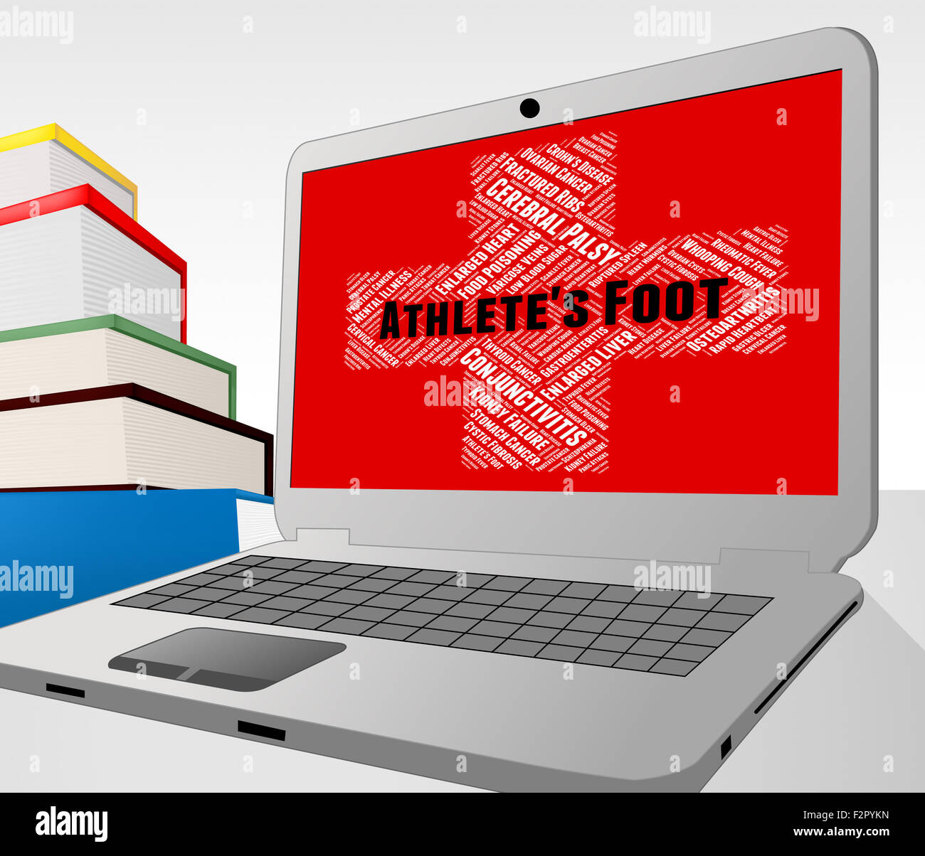 Athlete's Foot Representing Tinea Pedis And Disorders Stock Photo - Alamy