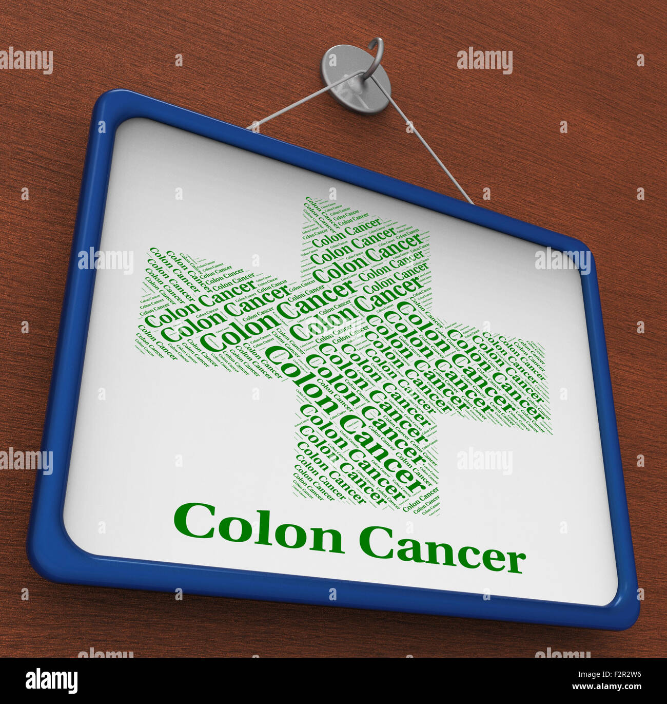 Colon Cancer Showing Large Intestine And Disease Stock Photo - Alamy