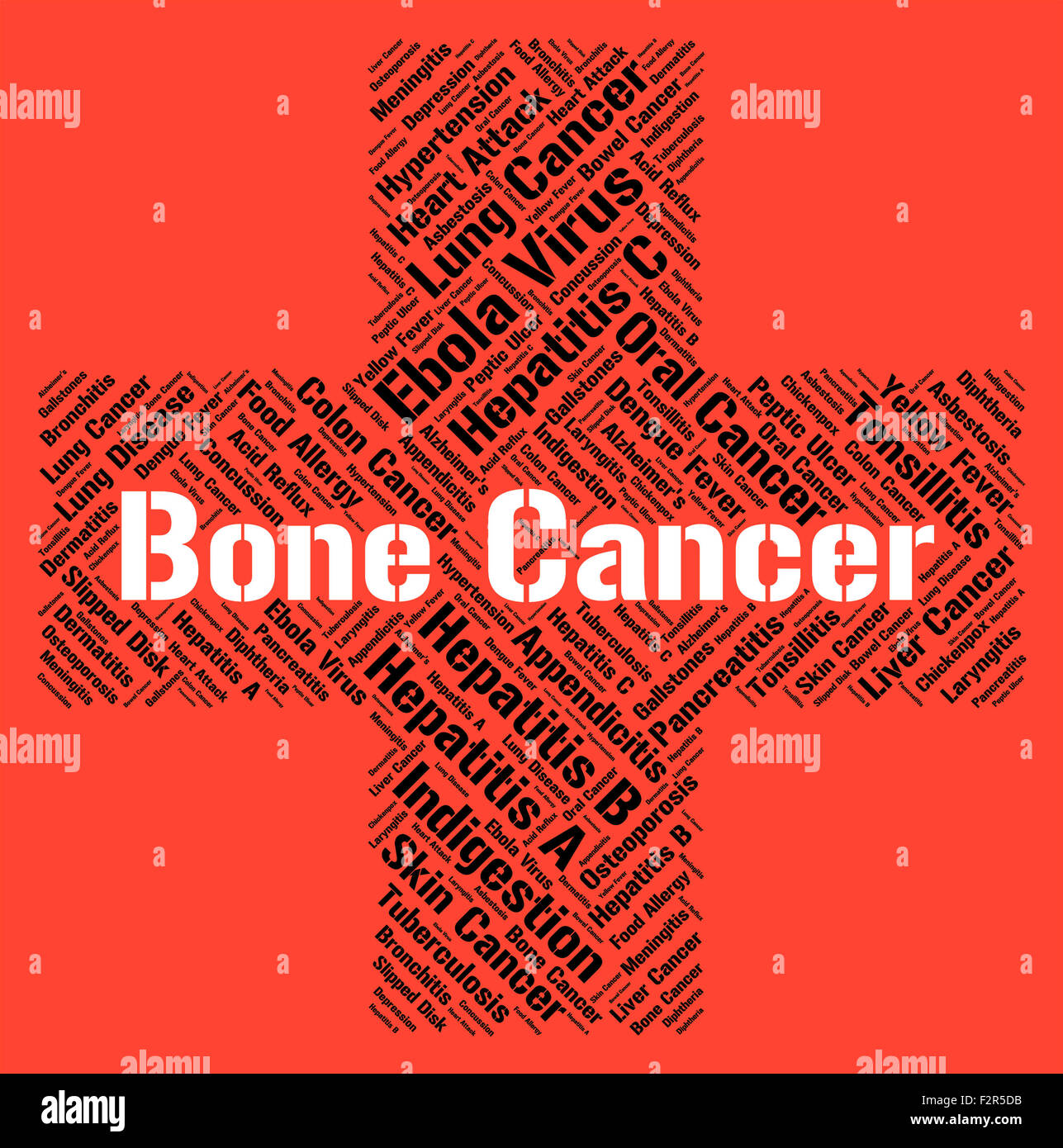 Bone Cancer Indicating Malignant Growth And Afflictions Stock Photo - Alamy