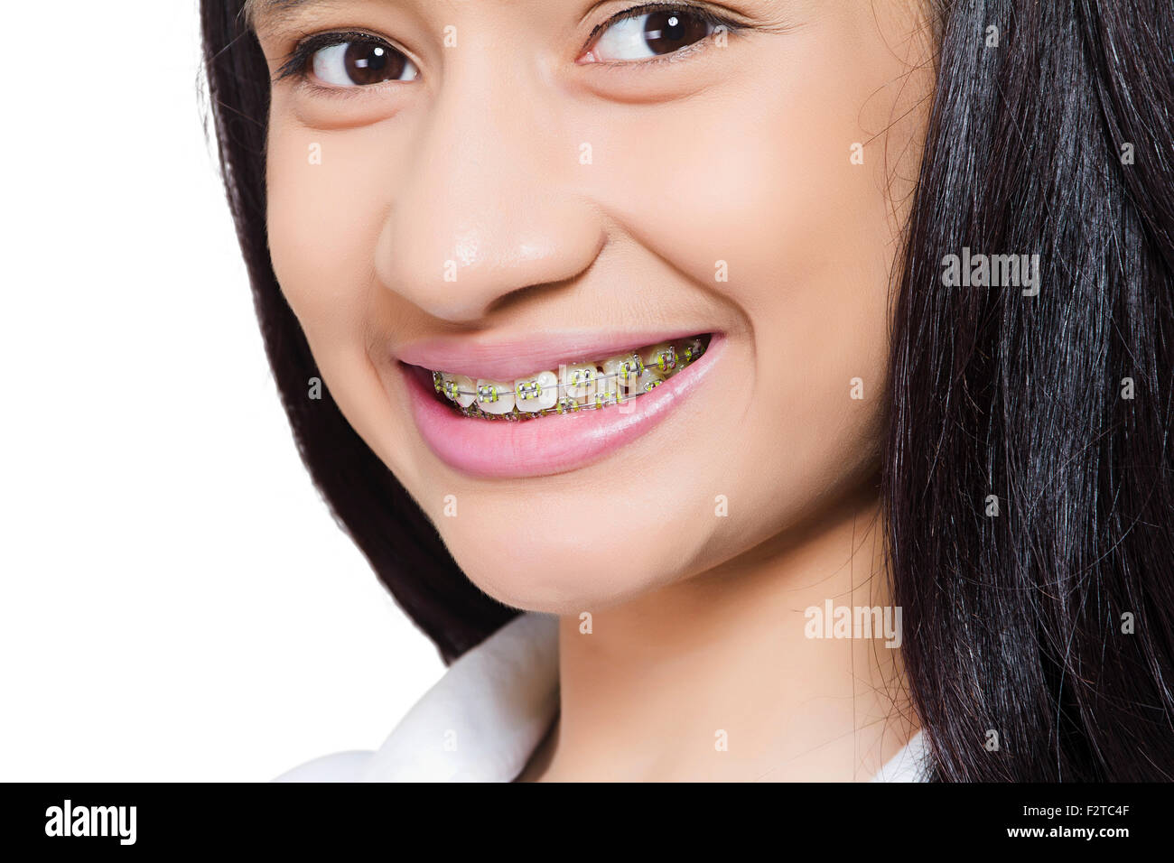 Teens Smiling Teeth White High Resolution Stock Photography and Images ...