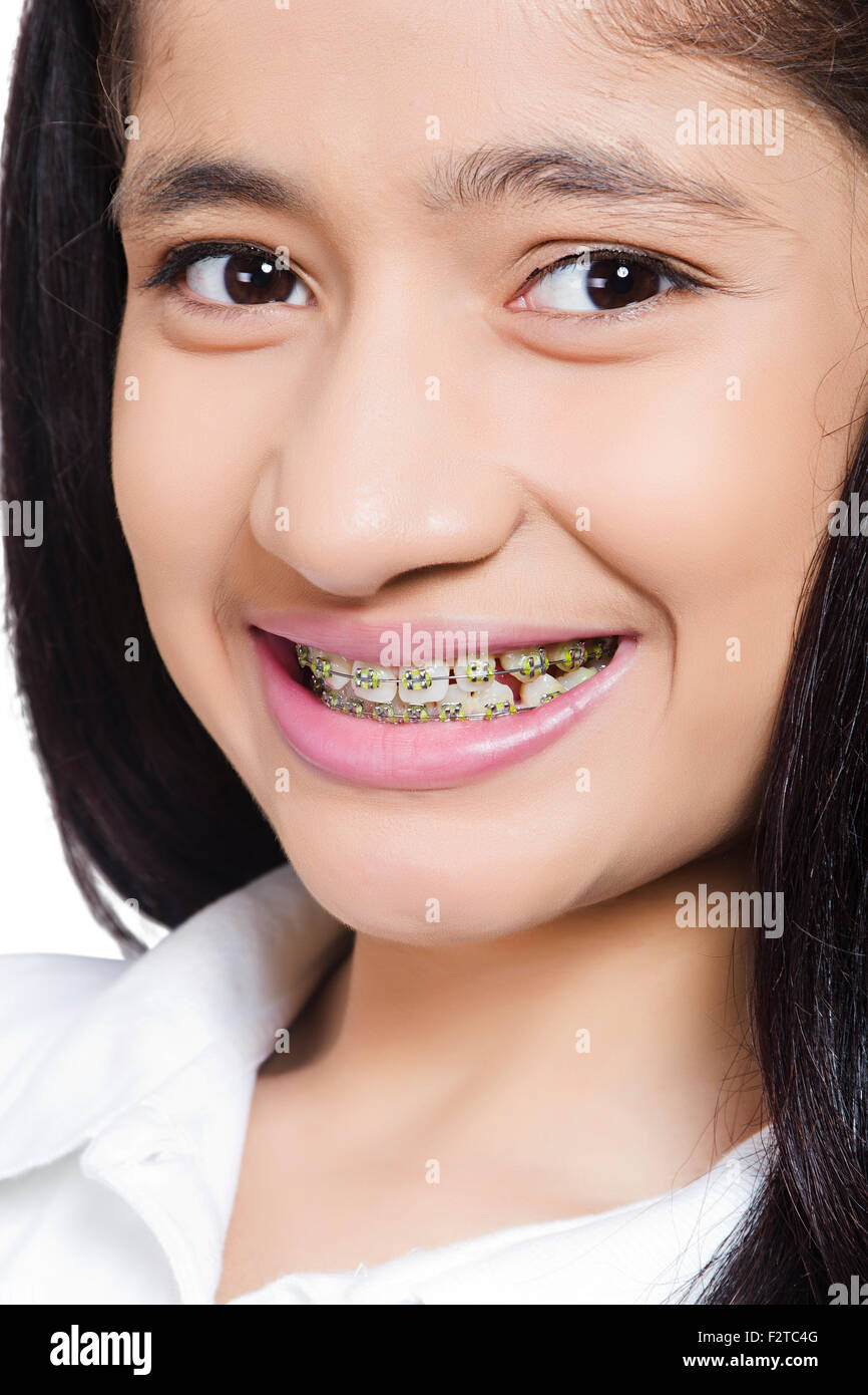 1 indian Teenager Girl Teeth Showing Stock Photo - Alamy