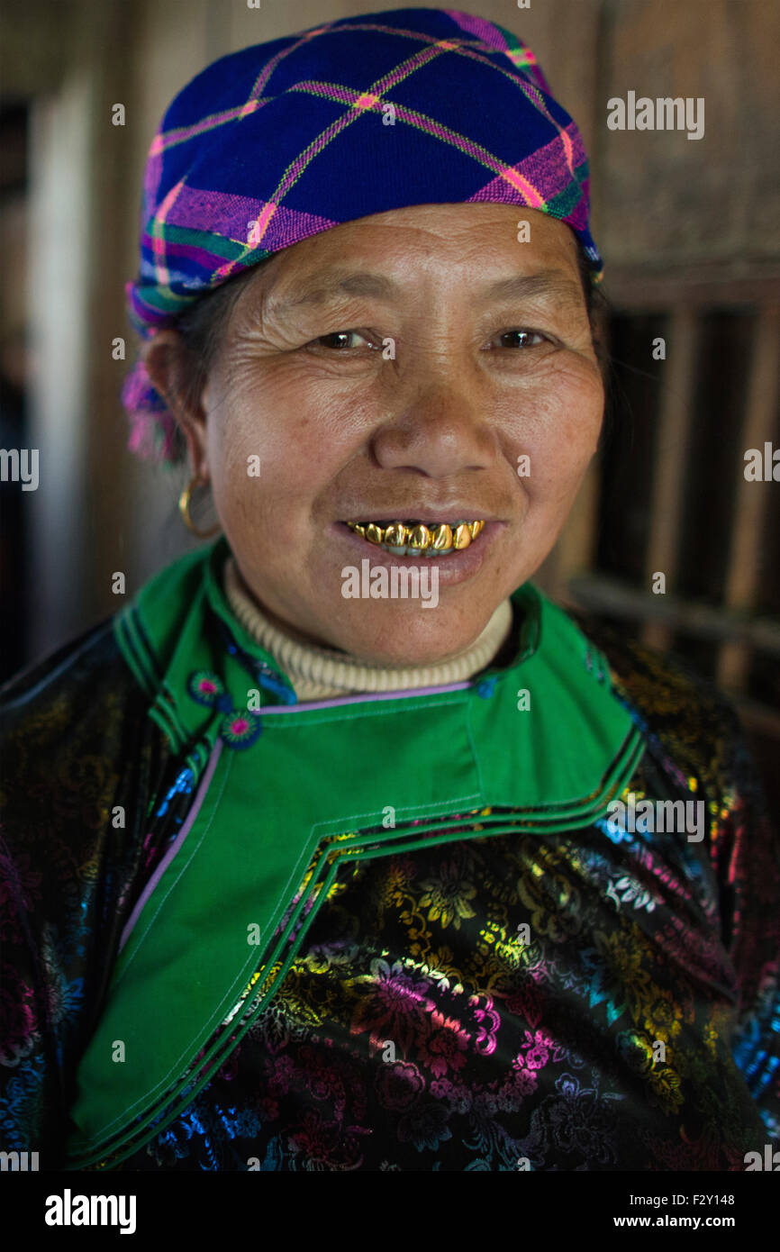 Women Black With Gold Teeth