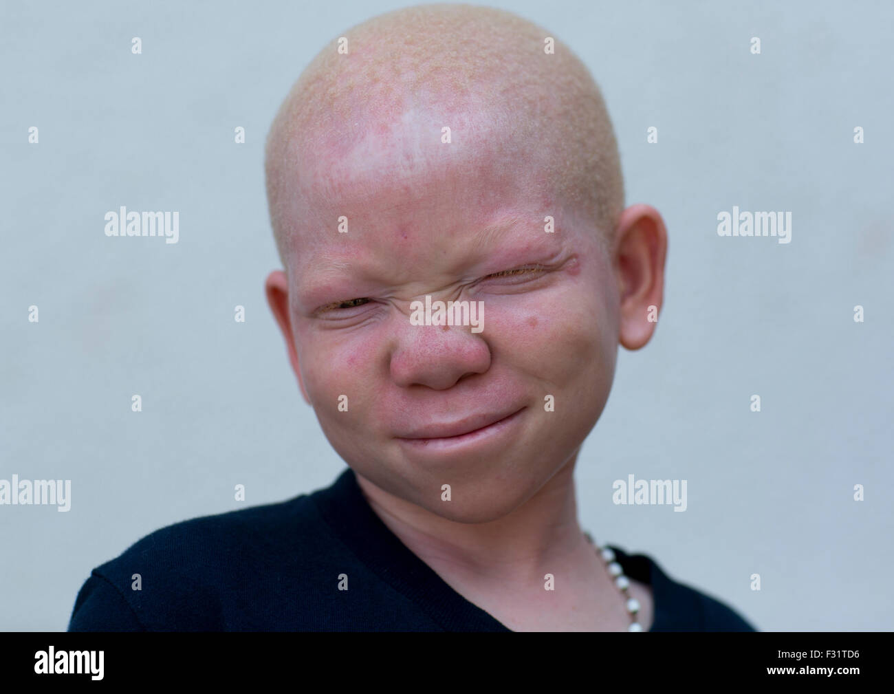 Tanzania, East Africa, Dar es Salaam, mwigulu matonange a boy with ...