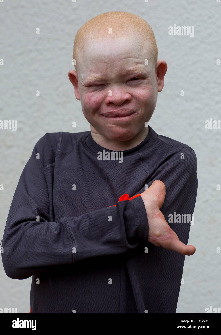 Tanzania, East Africa, Dar es Salaam, emmanuel festo a boy with ...