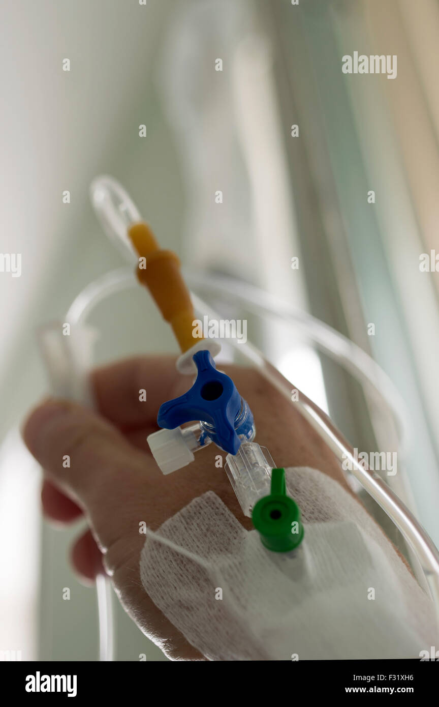 Catheterization hi-res stock photography and images - Alamy