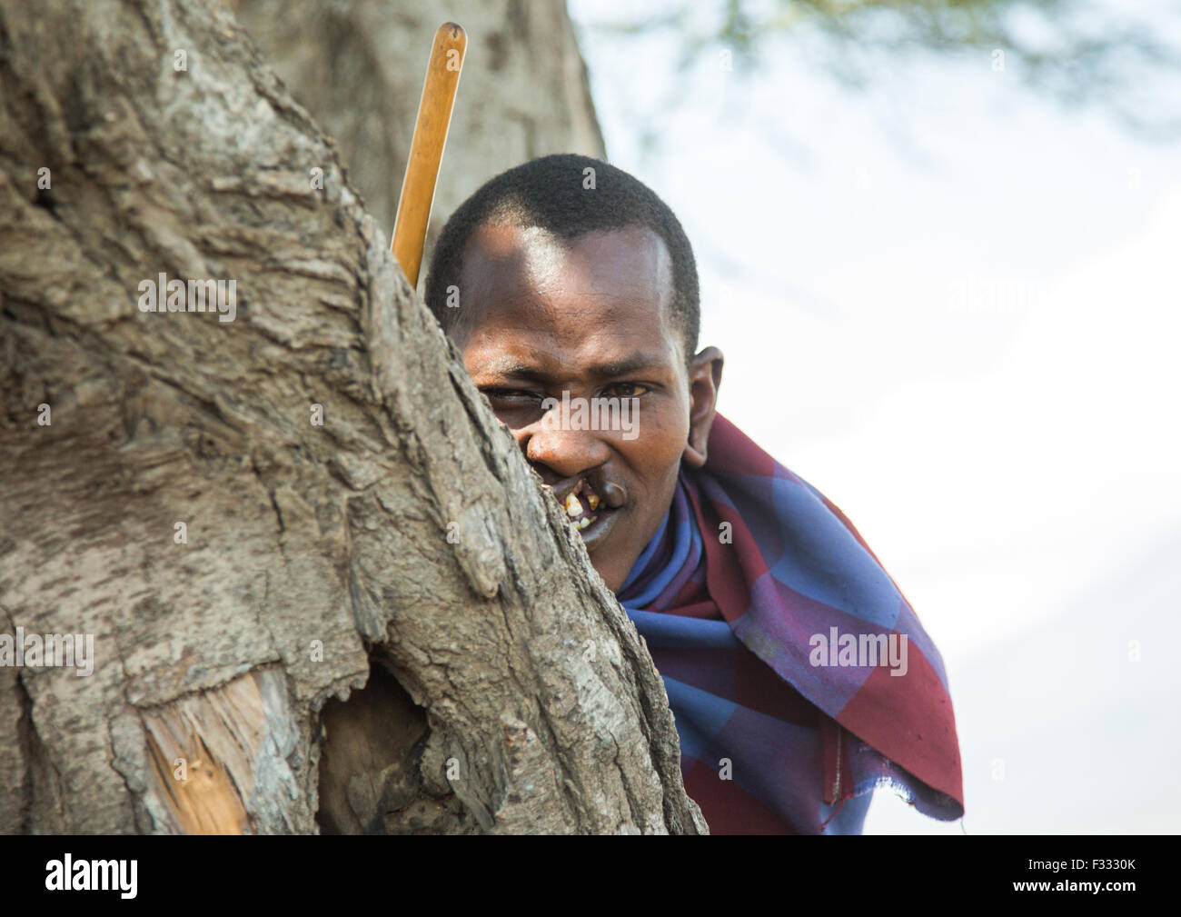 Harelip hi-res stock photography and images - Alamy