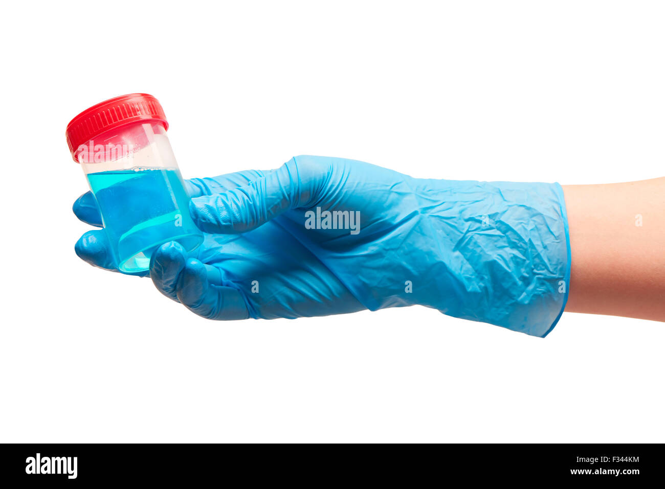 Surgical specimen hi-res stock photography and images - Alamy