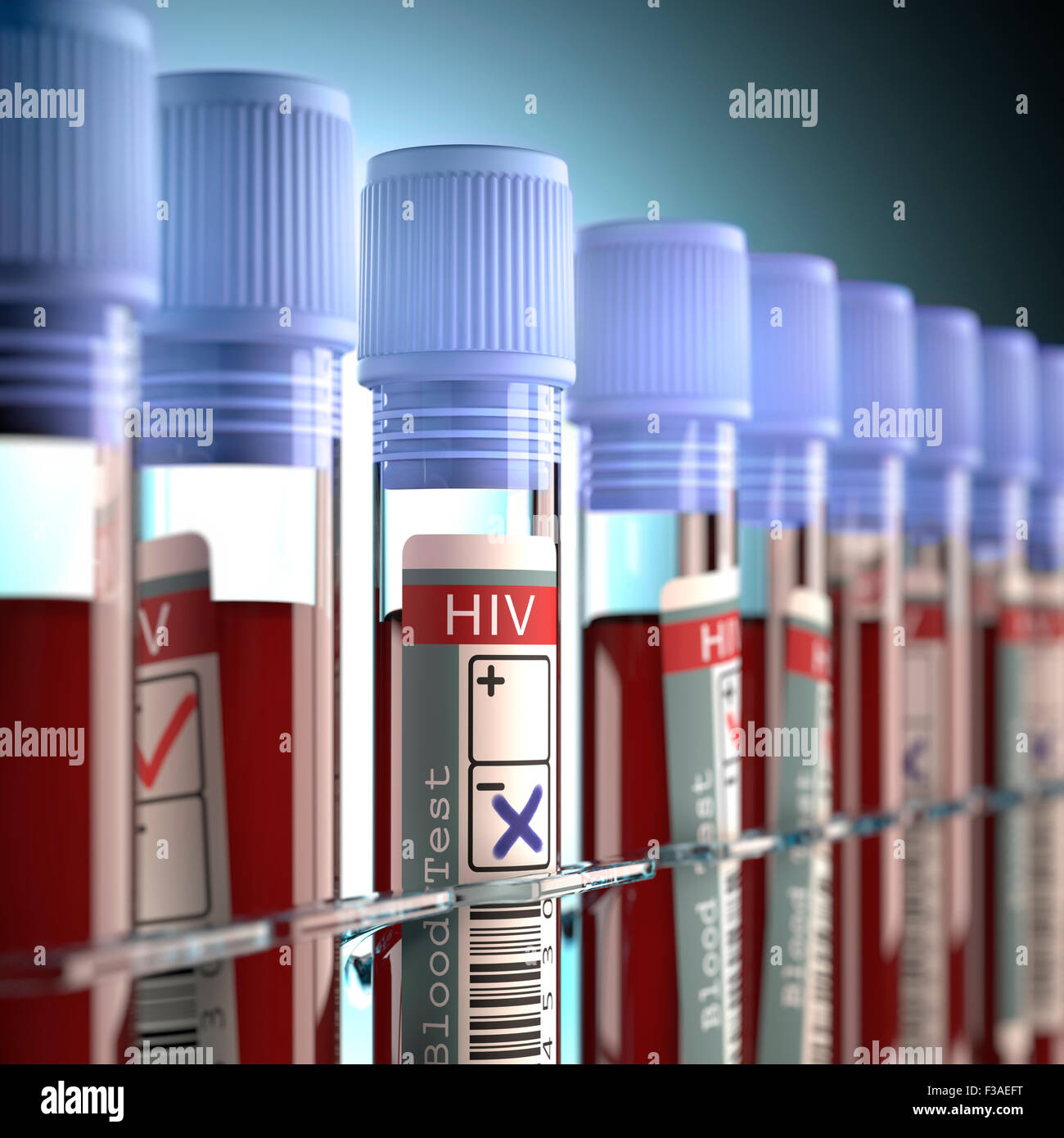 Blood samples for hiv tests hi-res stock photography and images - Alamy