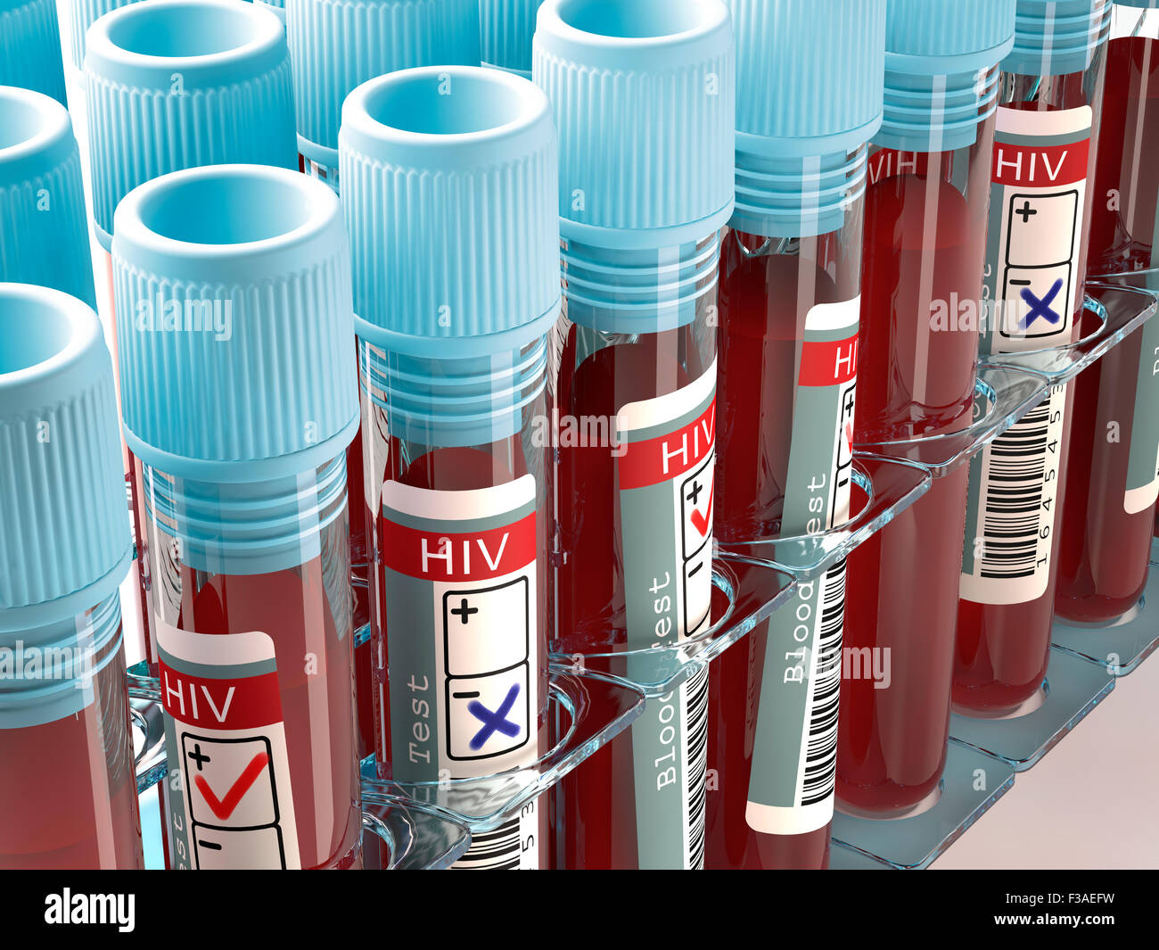 Blood samples in tubes to test for HIV (human immunodeficiency virus ...