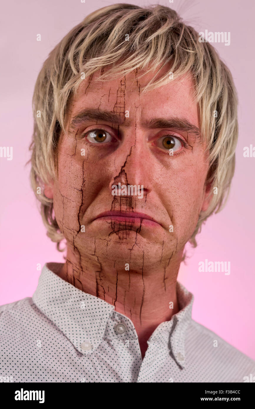 Dry skin face man hi-res stock photography and images - Alamy