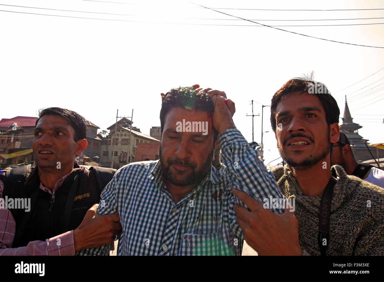 A injured cameraman is being taken to a hospital for treatment after he ...