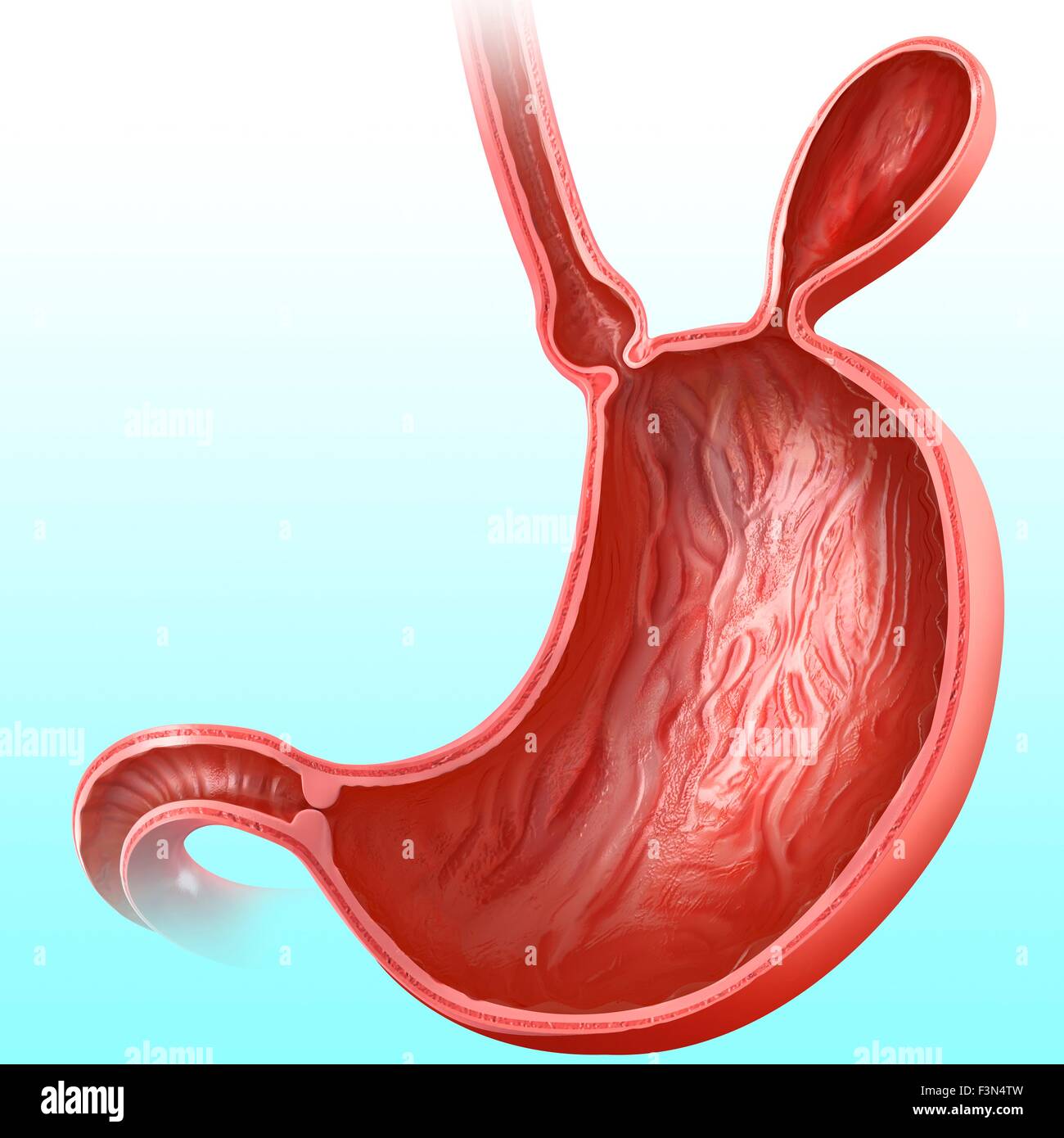 Stomach hernia illustration hi-res stock photography and images - Alamy