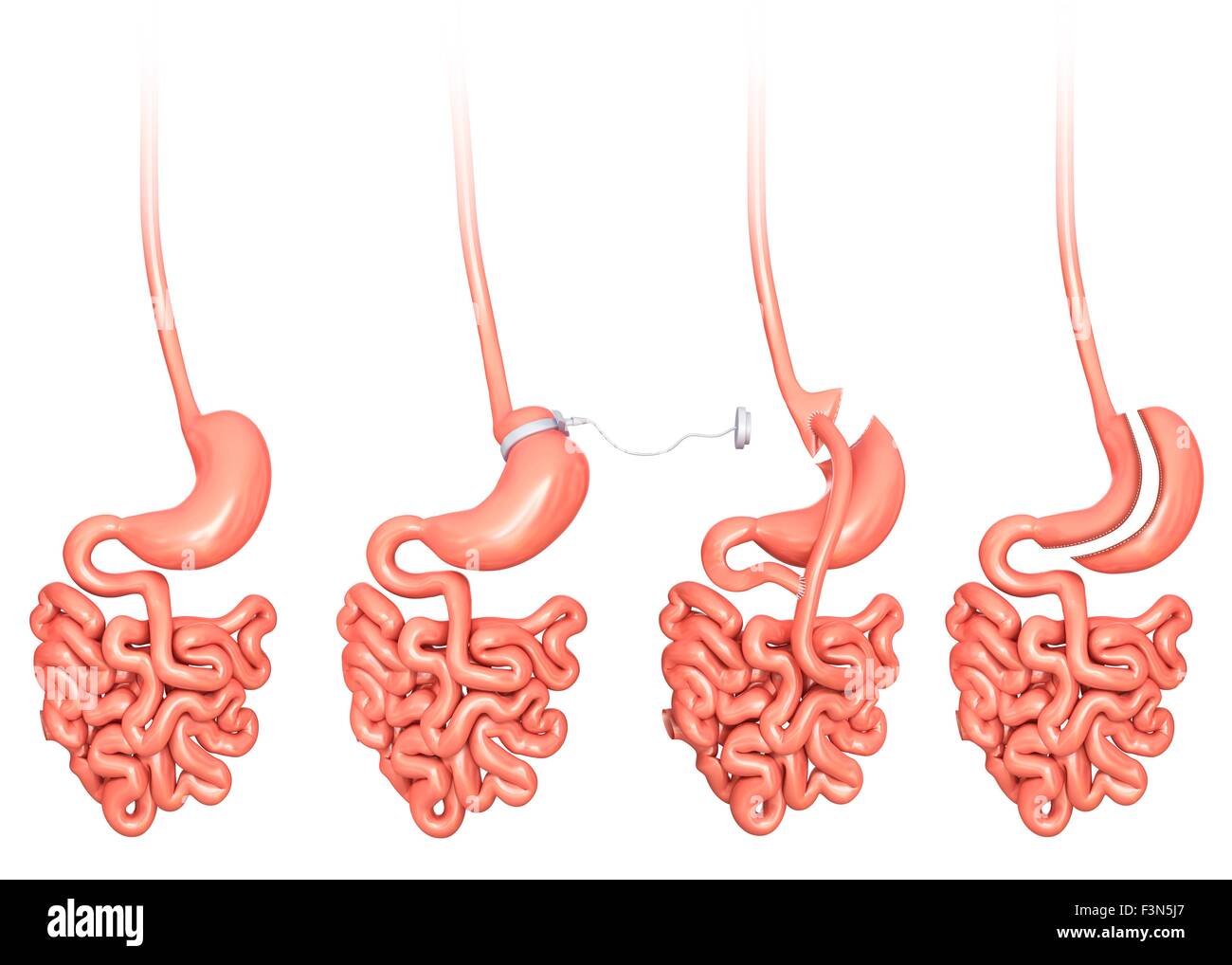 Surgery 3 Cut Out Stock Images & Pictures - Alamy