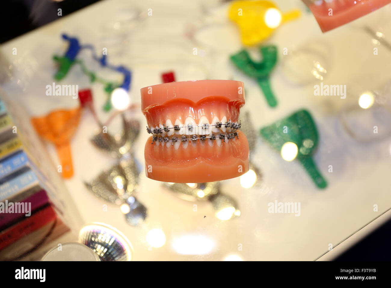 Plastic teeth with orthodontic brackets as a demo Stock Photo - Alamy