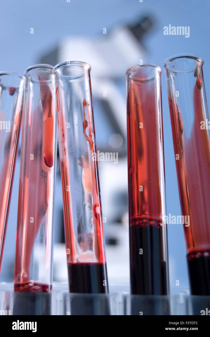 Test tubes of blood with microscope in background Stock Photo - Alamy