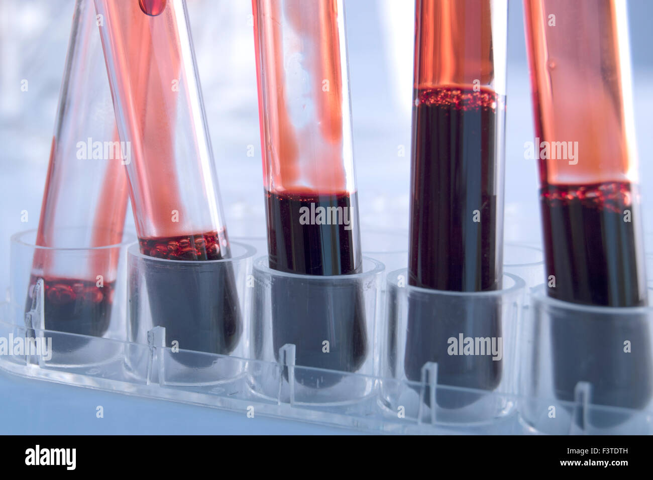 Test tubes of blood Stock Photo - Alamy