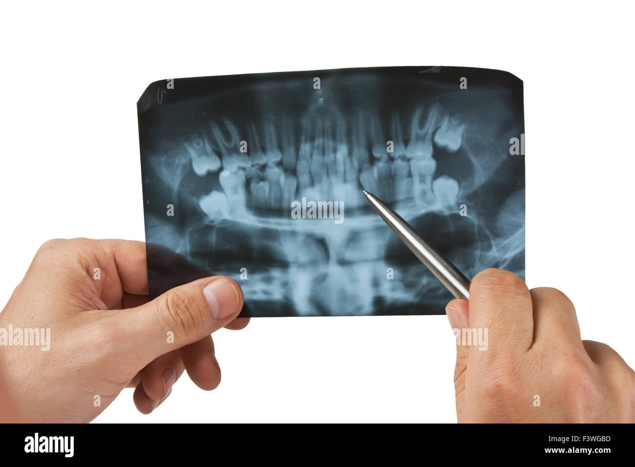 Doctor holds scan hi-res stock photography and images - Alamy