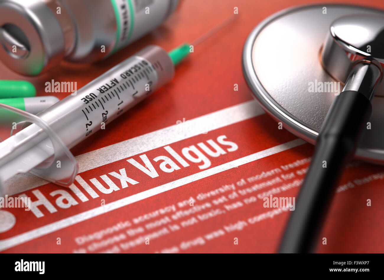 Hallux valgus surgery hi-res stock photography and images - Alamy