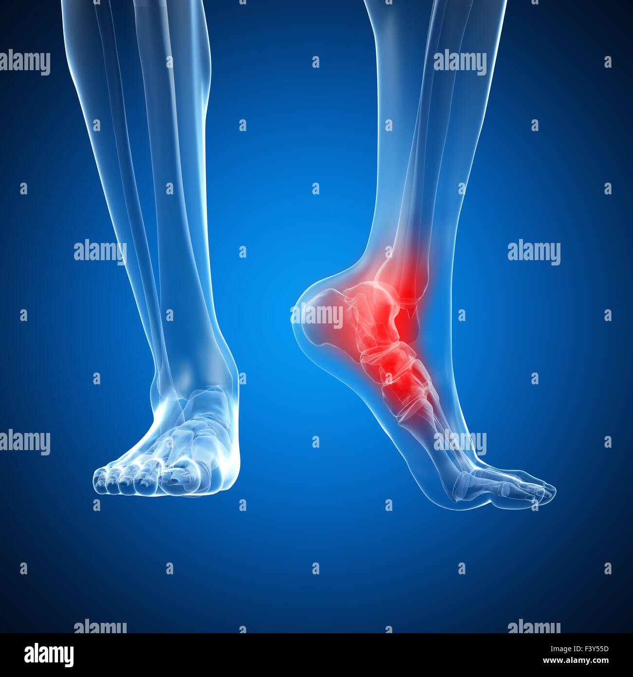 3d rendered illustration of a painful ankle Stock Photo - Alamy