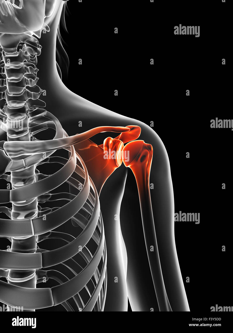 Woman inflammation shoulder joint hi-res stock photography and images ...