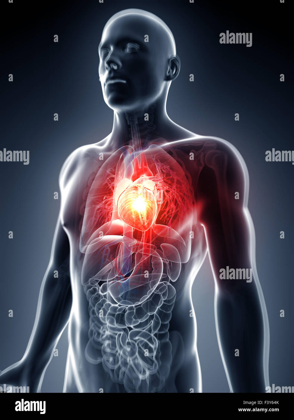 3d rendered illustration - heart attack Stock Photo - Alamy