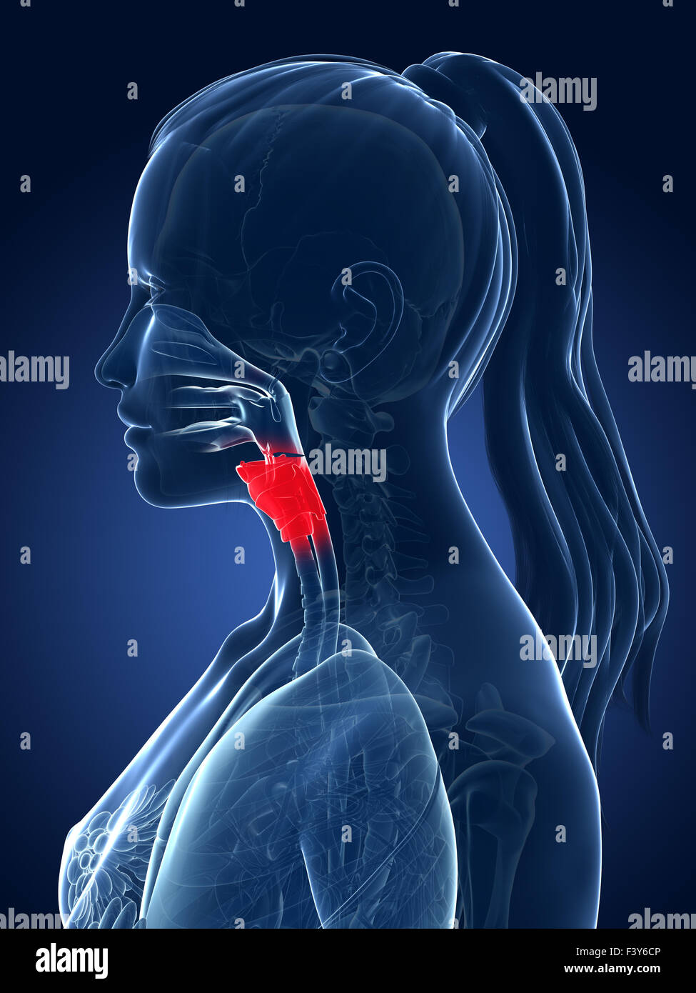 Larynx cancer hi-res stock photography and images - Alamy