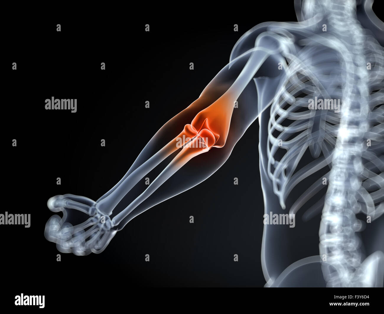 Bursitis hi-res stock photography and images - Alamy