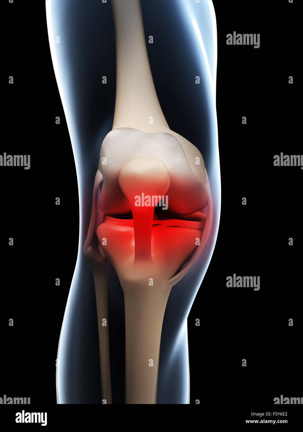 Painful ligament hi-res stock photography and images - Alamy