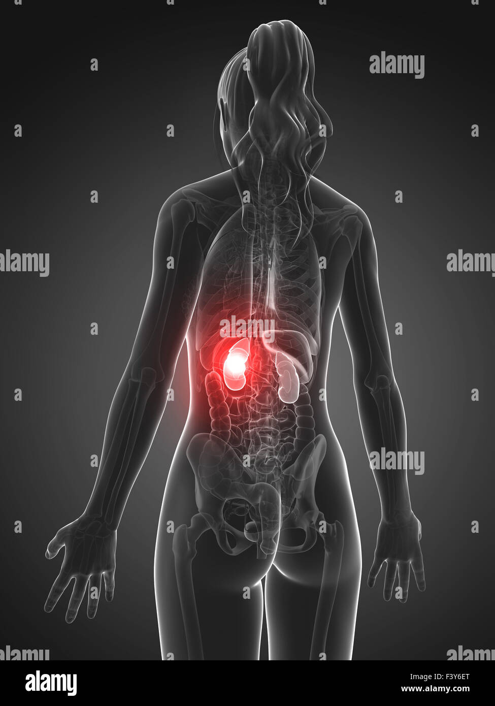 Renal failure hi-res stock photography and images - Alamy