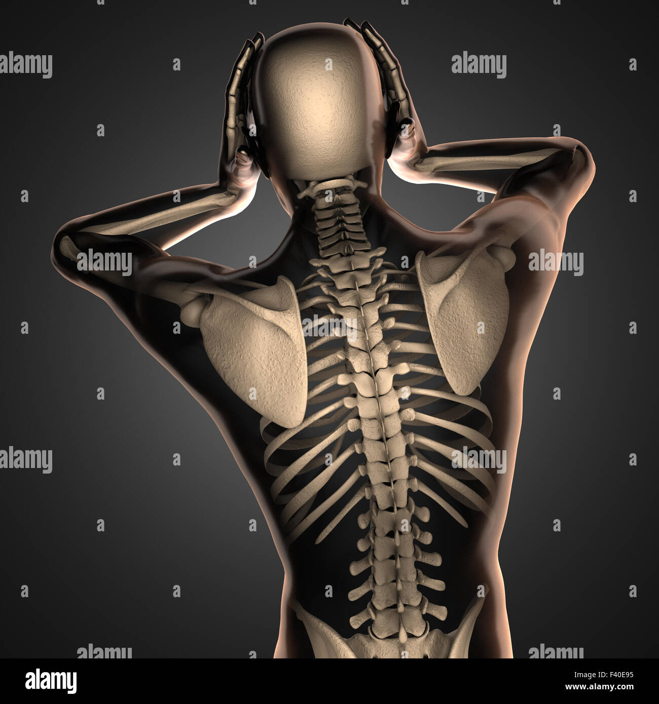 human radiography scan with bones Stock Photo - Alamy