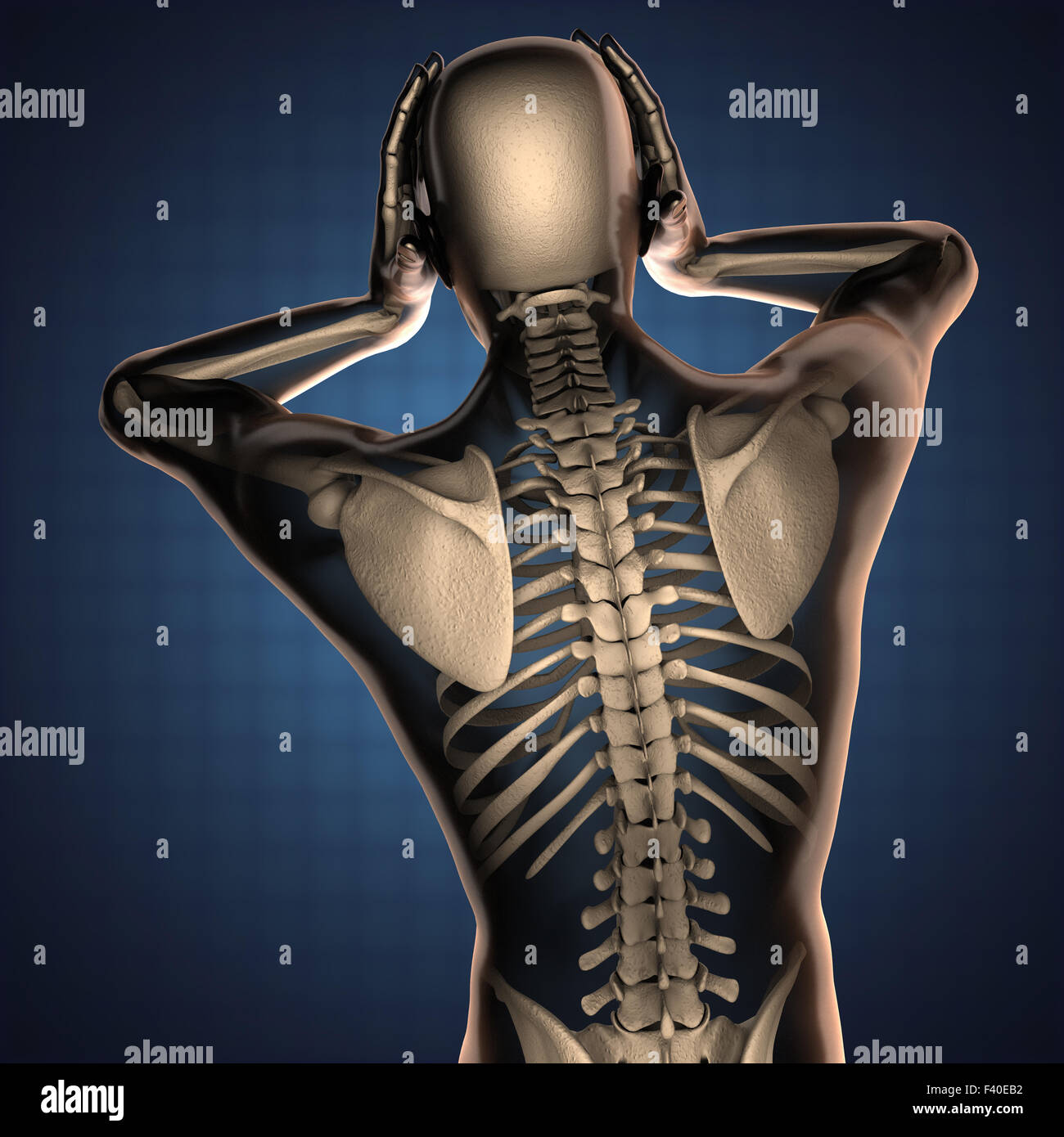 Bones scan hi-res stock photography and images - Alamy