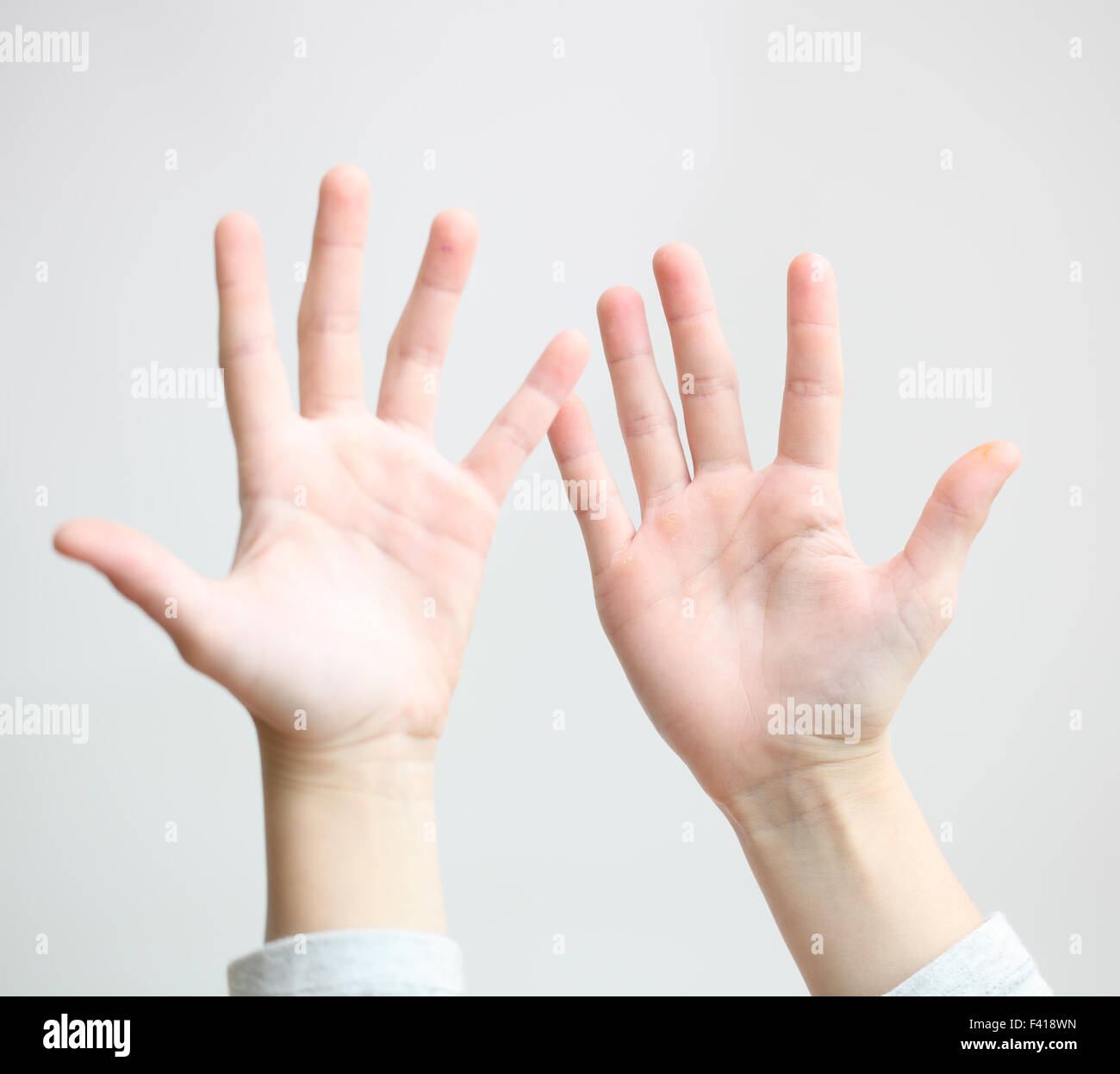 Arm raised anatomy hi-res stock photography and images - Alamy