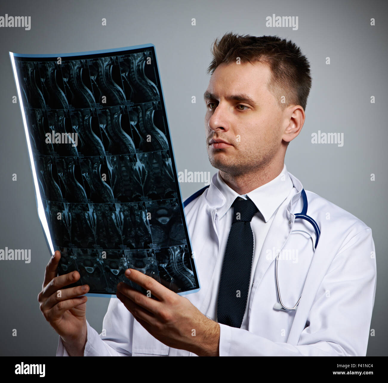 Medical doctor with MRI spinal scan Stock Photo - Alamy