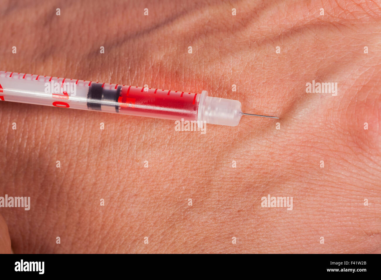 Concept Image - Surgical Aftermath Image of Needle Syringes and IV ...
