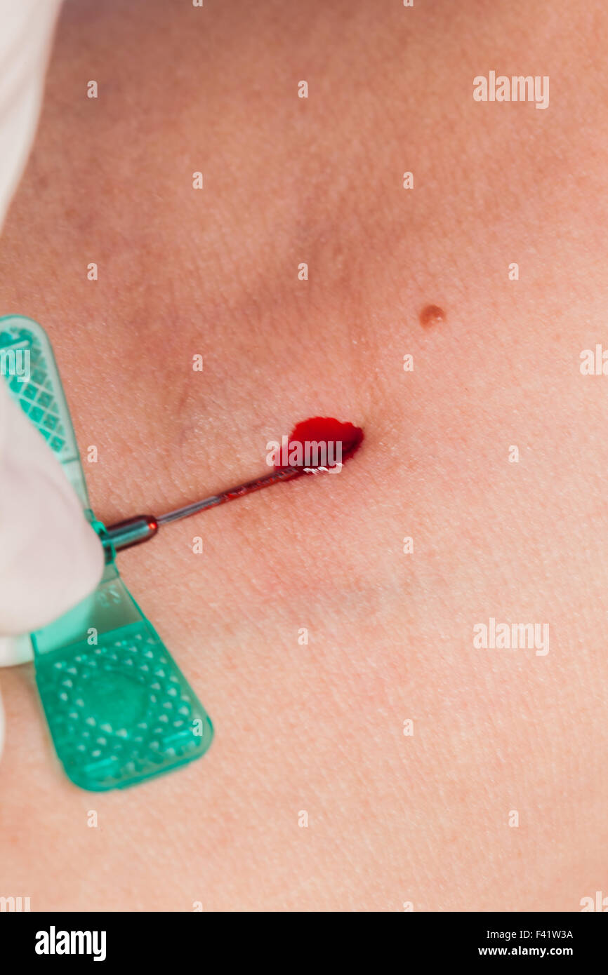Iv lines hi-res stock photography and images - Alamy