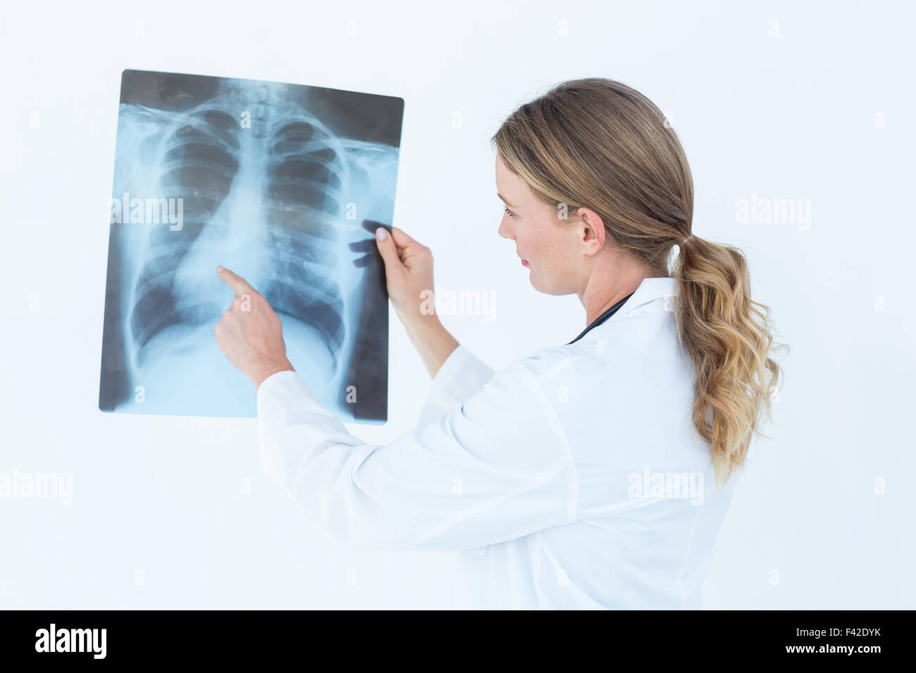 Focused doctor looking at xray Stock Photo - Alamy