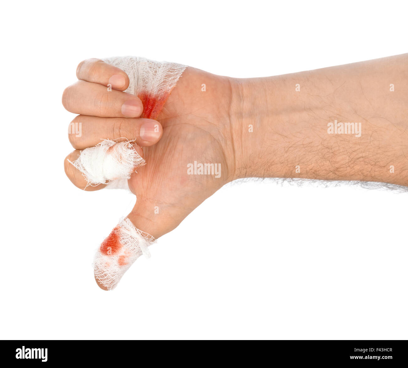 Hand thumb with blood and bandage Stock Photo - Alamy
