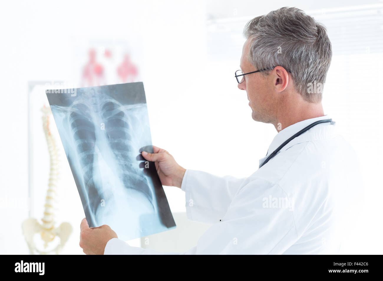 Doctor looking at chest xray hi-res stock photography and images - Alamy