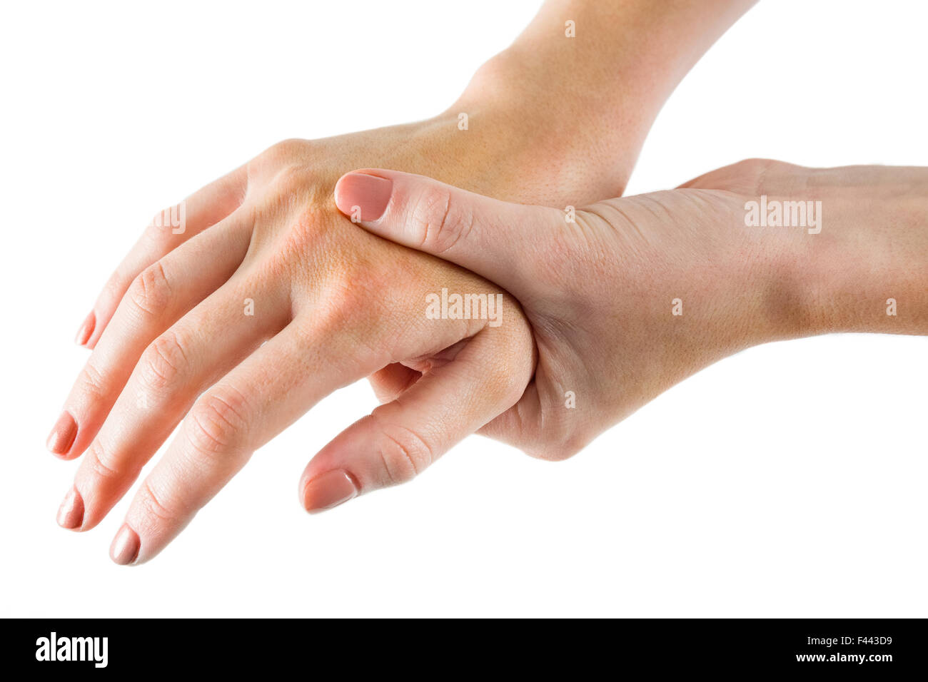 Woman with hand injury Stock Photo - Alamy