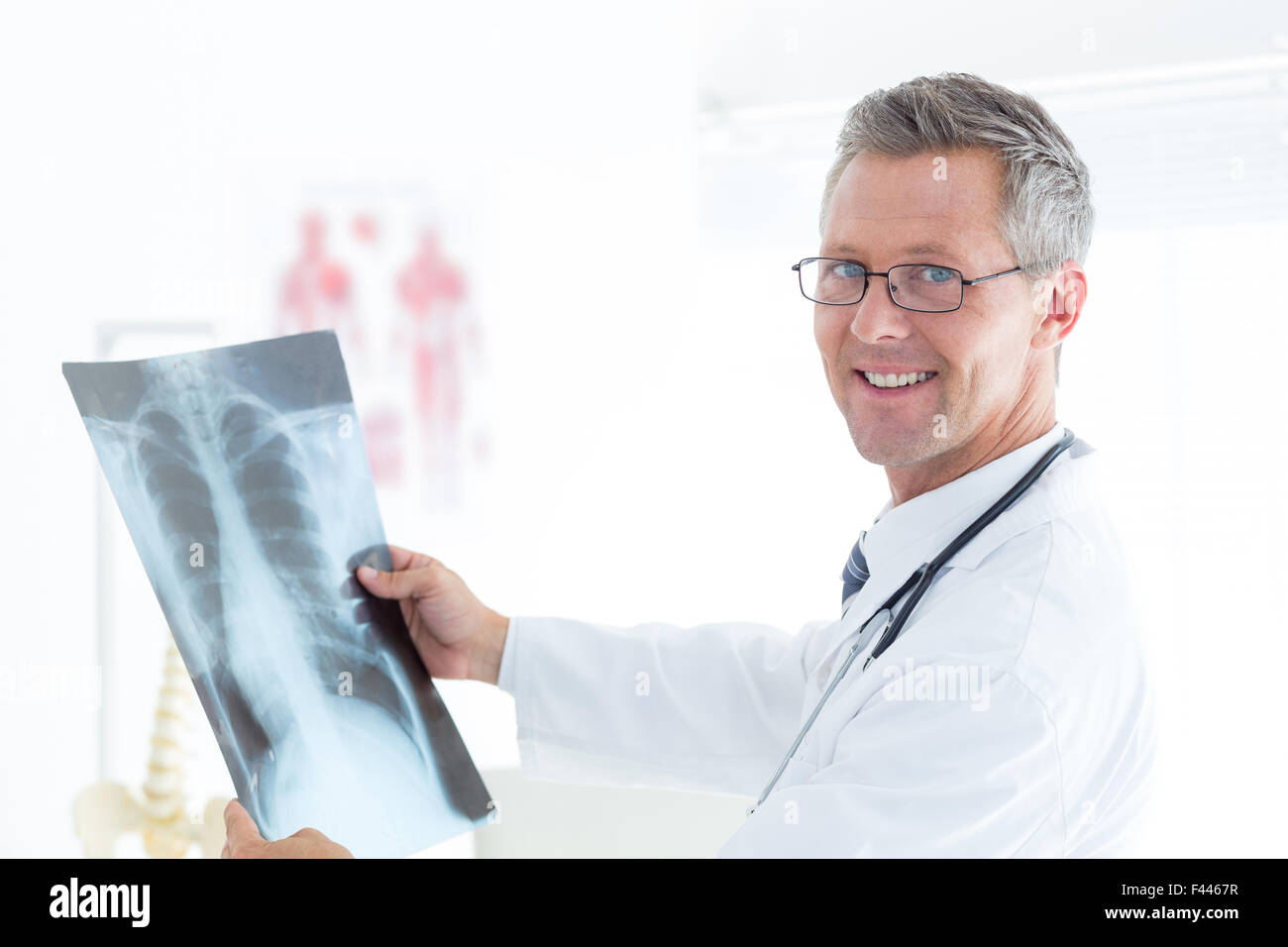 Doctor looking at chest xray hi-res stock photography and images - Alamy