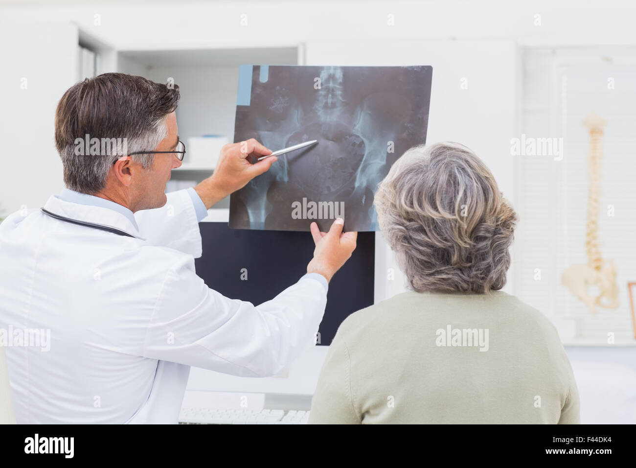 Doctor explaining x-ray to female patient Stock Photo - Alamy
