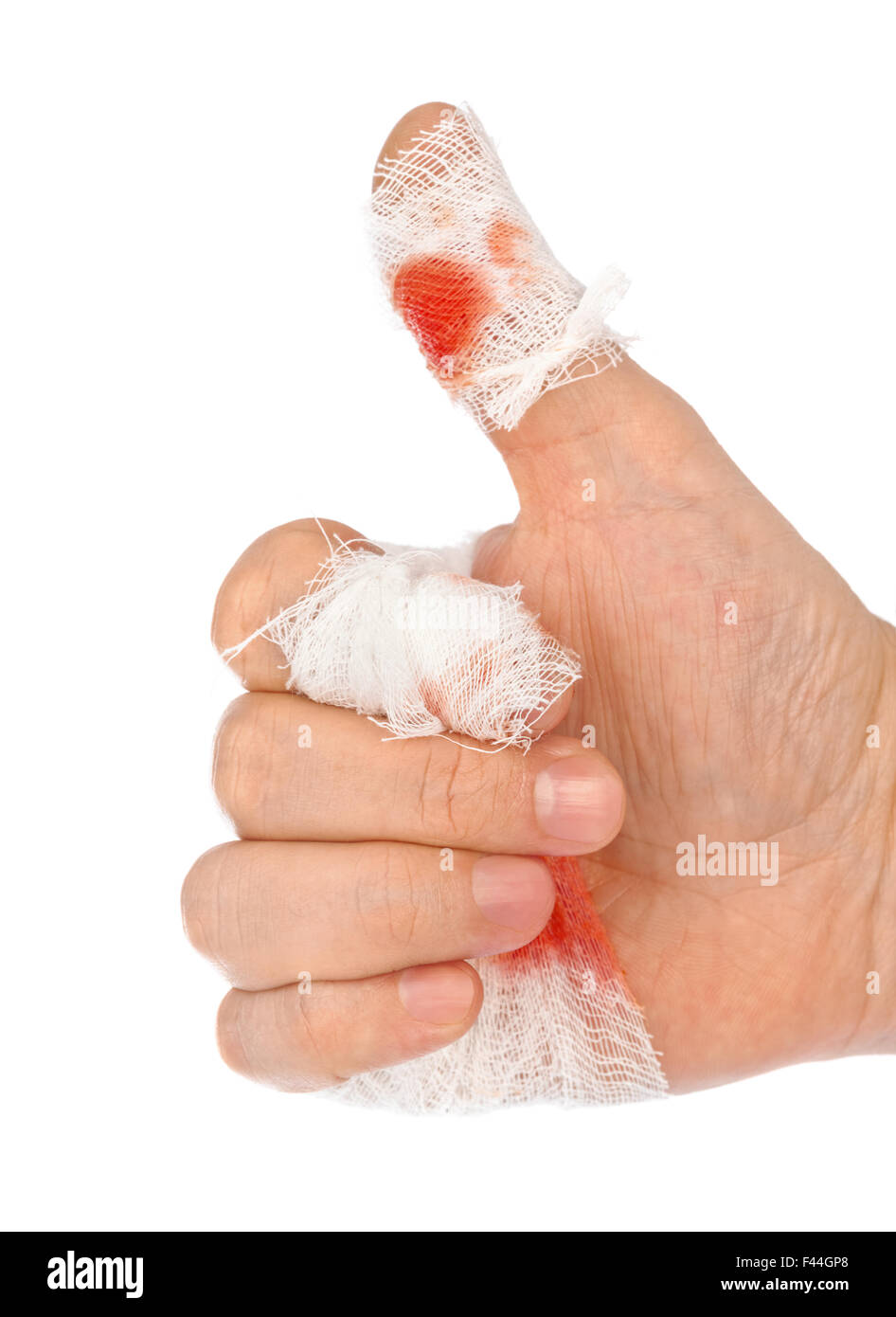 Bandaged thumb hi-res stock photography and images - Alamy