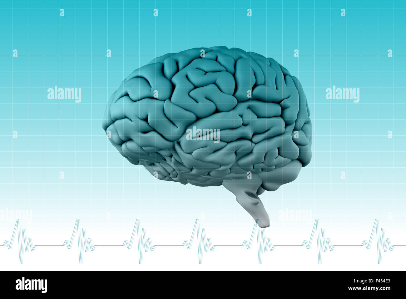 Brain electrode hi-res stock photography and images - Alamy