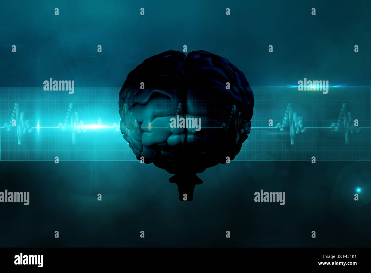 Electrode brain hi-res stock photography and images - Alamy