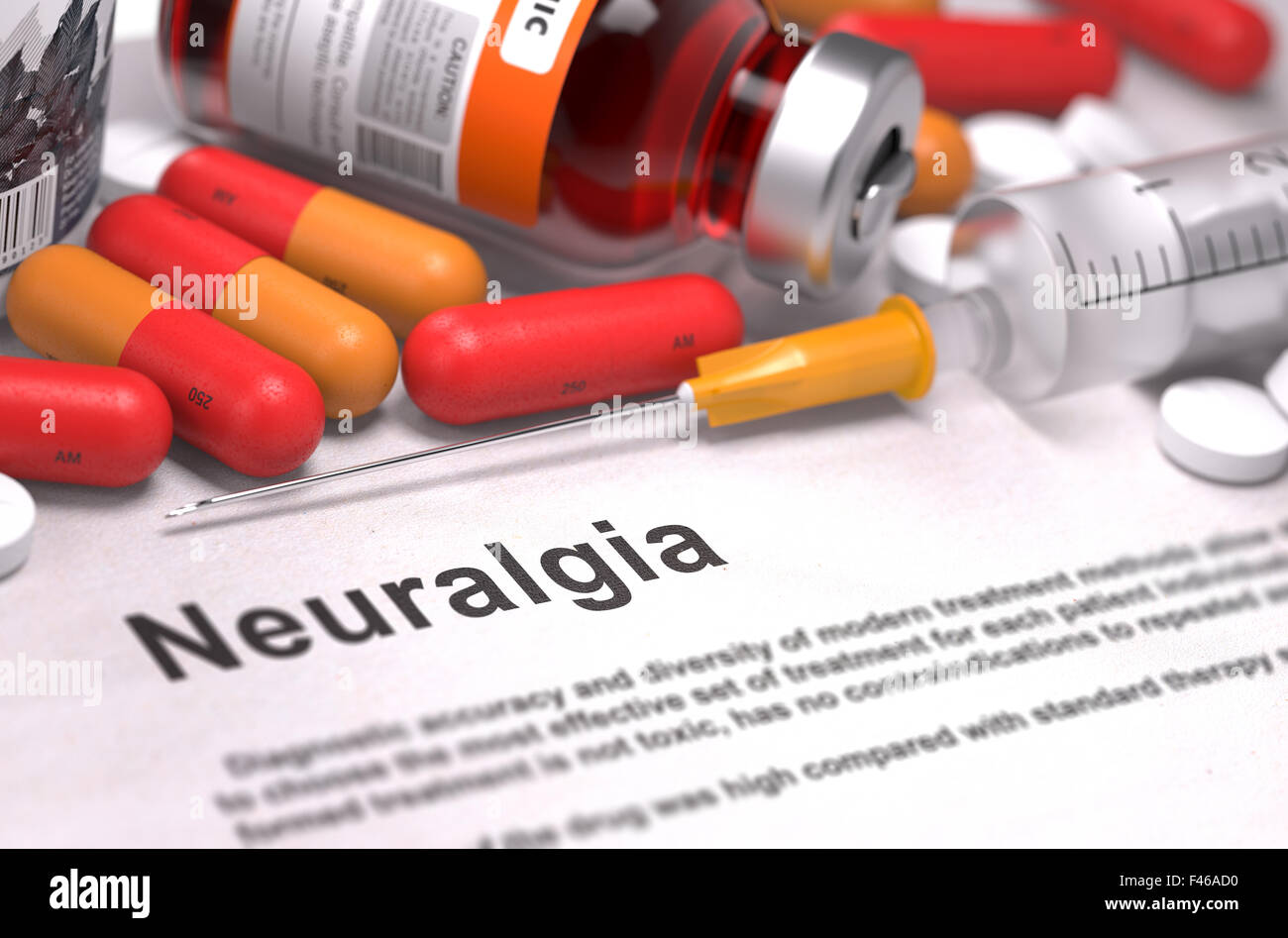 Neuralgia hi-res stock photography and images - Alamy